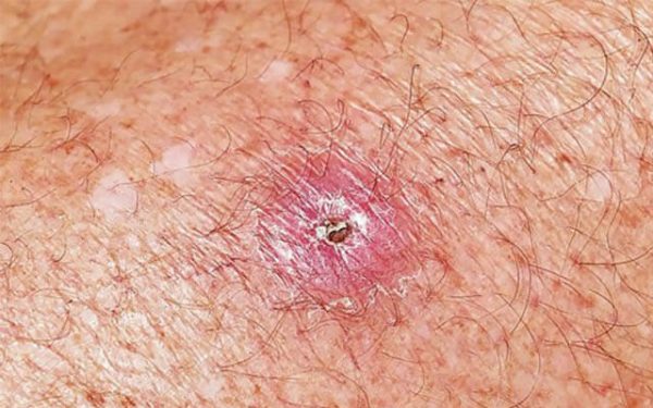 Hoa cứt lợn: đặc điểm, công dụng, sơ chế và các bài thuốc